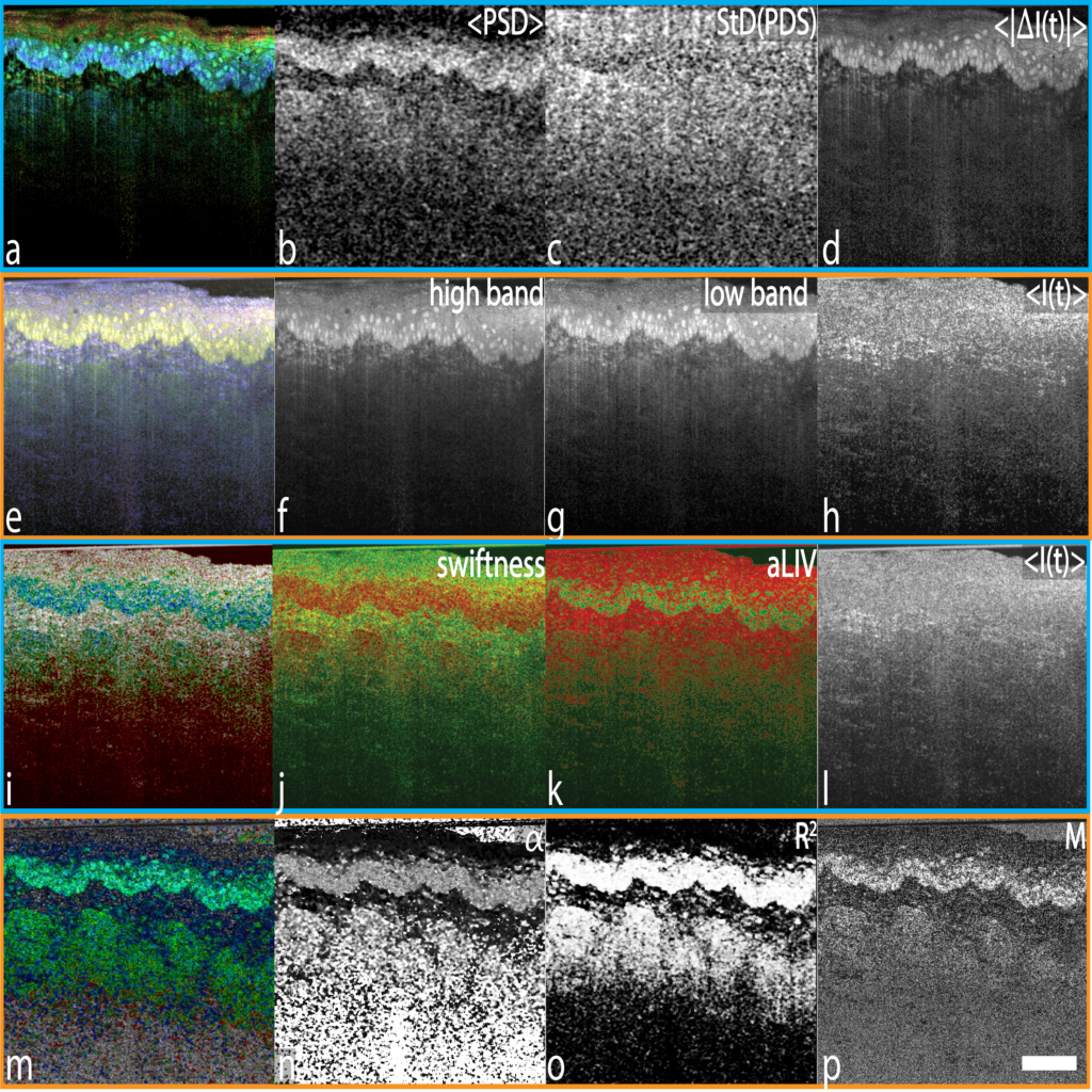 News: Institute for Biomedical Optics
